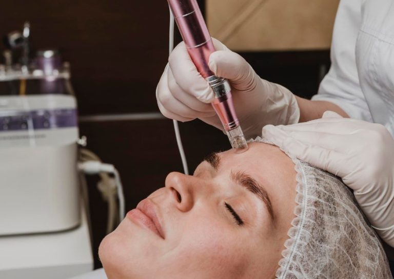 Pico Laser Treatment for Large Pores
